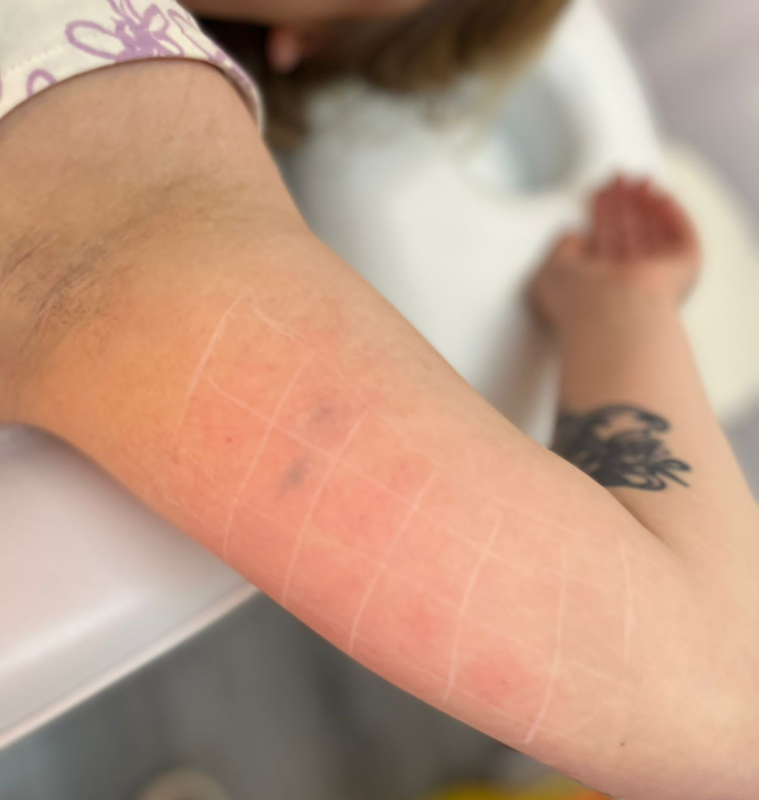 Bingo Wings mapping and after - Luxx International Cosmetics Academy